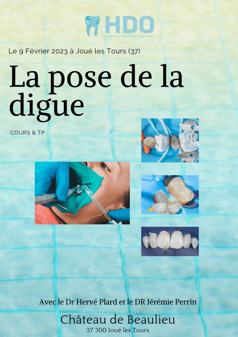 Pose de la digue - HDO Hightech Dentaire Orléanais